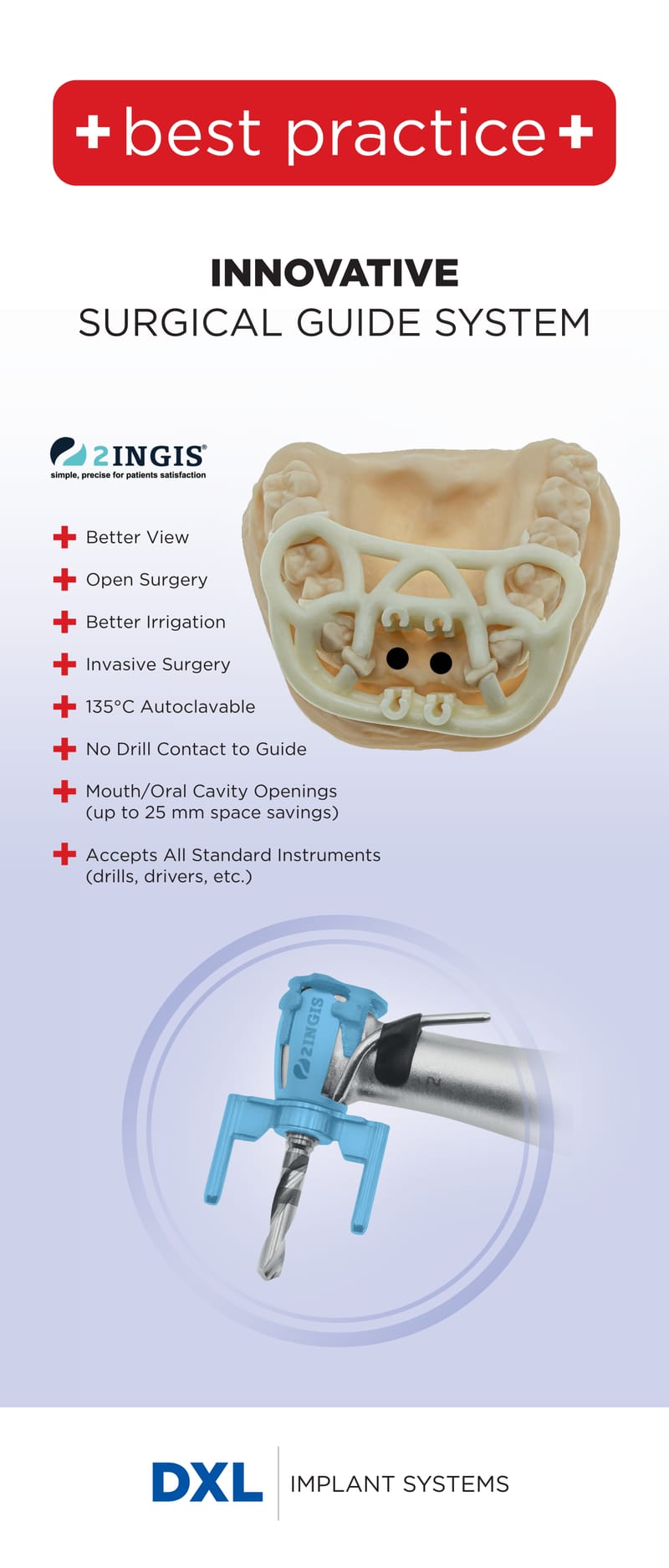 ALIEN IMPLANTS TODAY "Genius" GUIDED SURGERY CUSTOM-MADE STENT - ALIEN ...