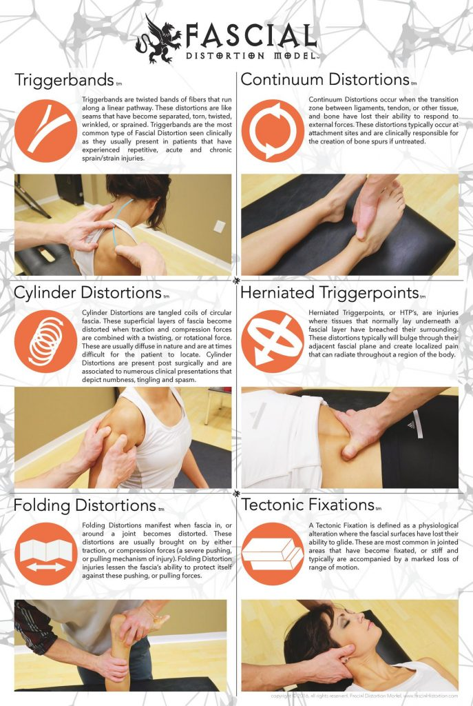 FDM (FASCIA DISTORTION MODEL) TECHNIQUE - Gálfi Lotti gyógytorna ...